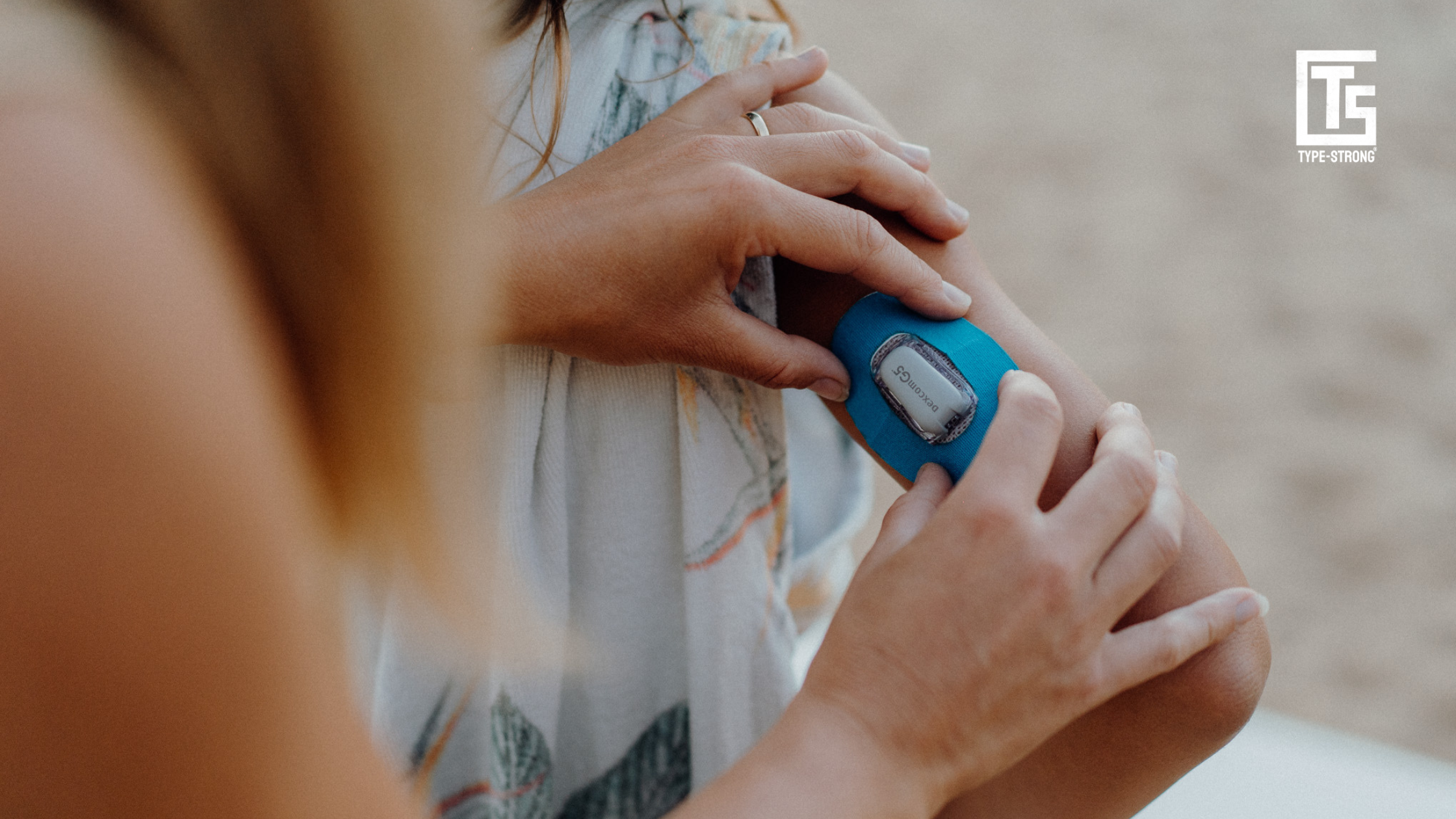 Five expert tips to keep your Dexcom G6 patch secure through anything